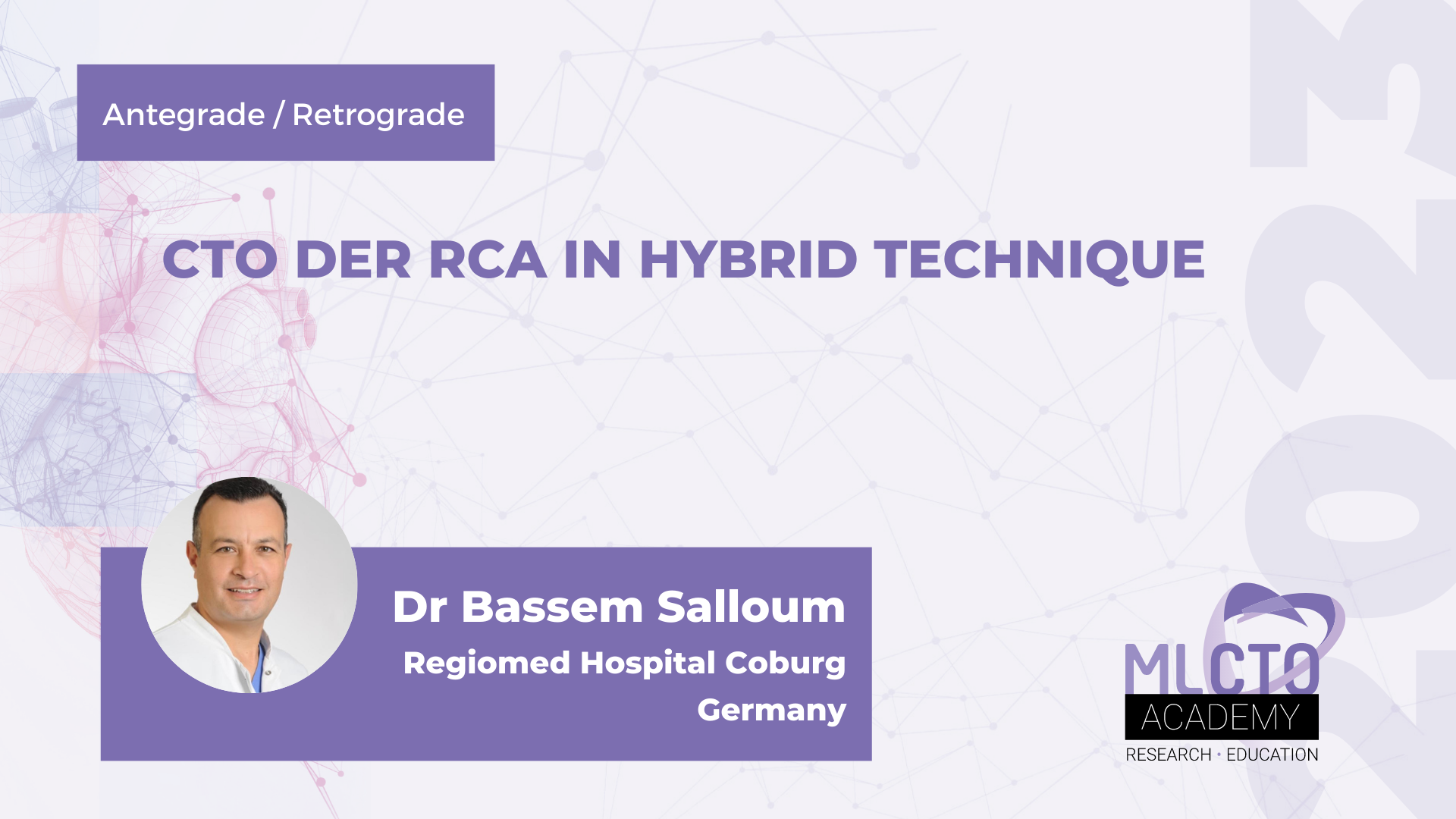Cto Der Rca In Hybrid Technique Mlcto Academy
