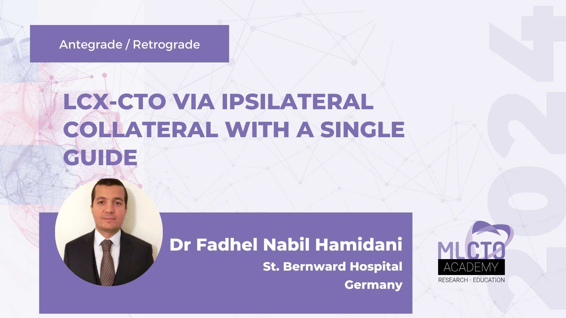 LCX-CTO VIA IPSILATERALCOLLATERALWITH A SINGLE GUIDE | MLCTO Academy