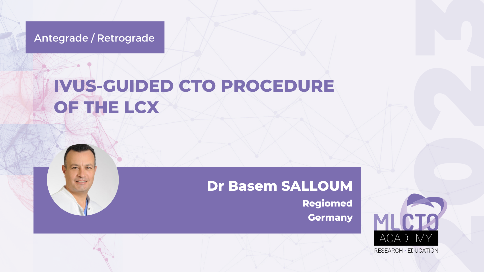 IVUS-guided CTO procedure of the LCX | MLCTO Academy