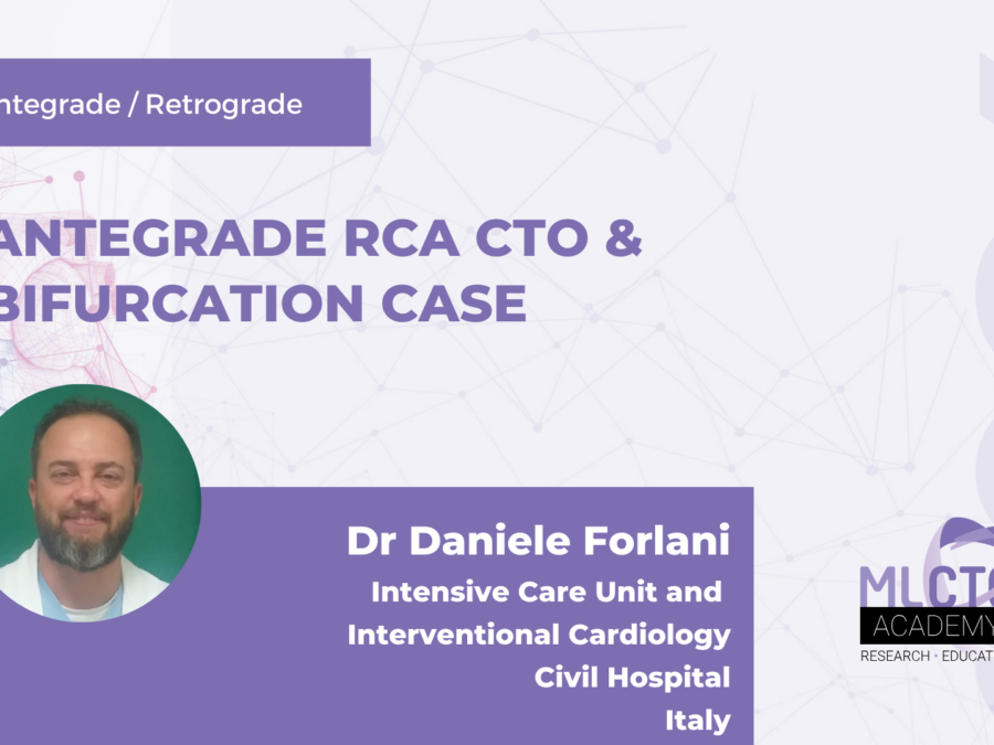 Impella-assisted PCI: 4 technologies, 3 vessels, 2 bifurcations and 1 ...